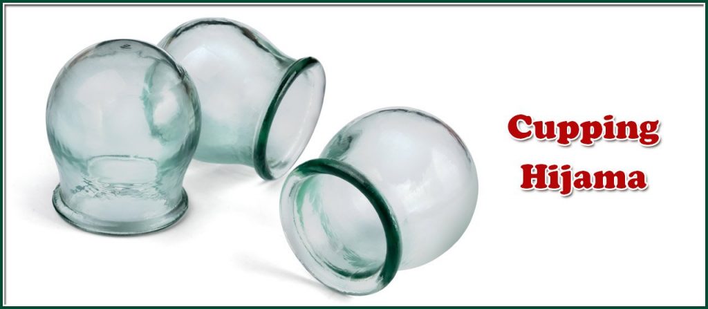 Hadiths on Cupping | Days recommended for Hijaama | Jannat Al Quran